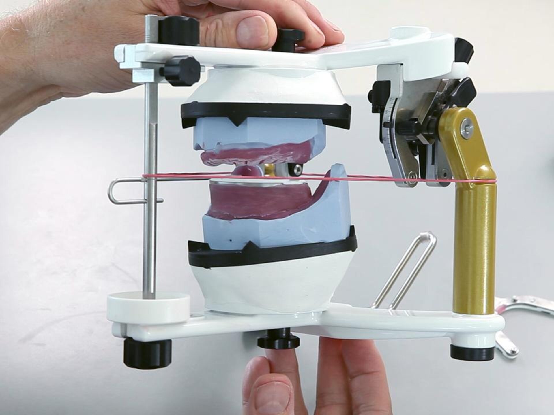 Removable Prosthetics Conventional | Dental Workflows | Ivoclar